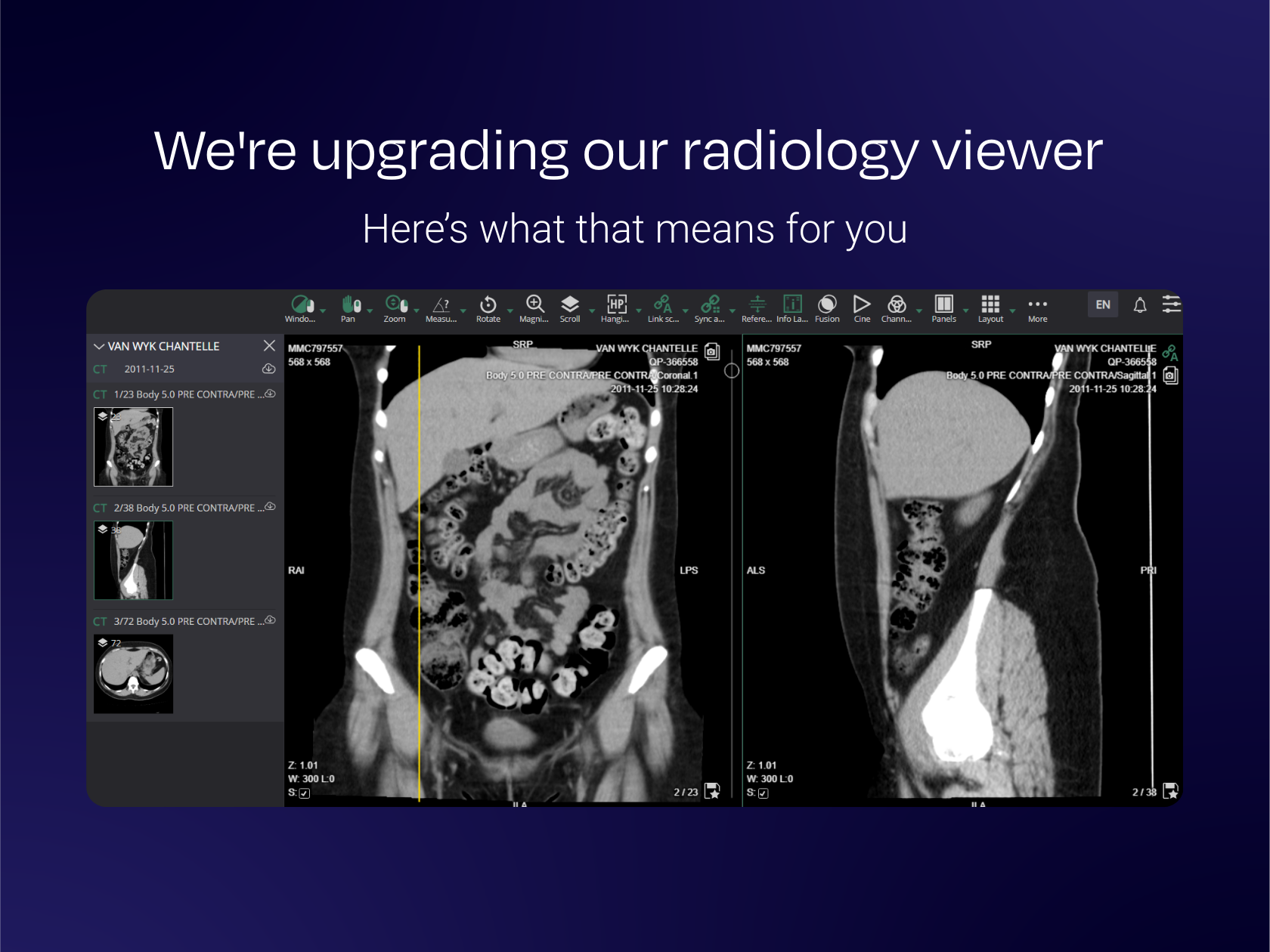 We're upgrading our radiology viewer - MedBrief Services Limited